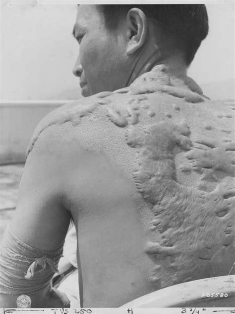 El Horror De Hiroshima Un Millón De Grados En El Aire Y Gente Que Se