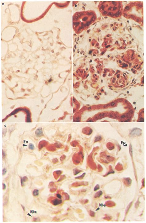 Nonspecific Esterase Nse Stains Of Rabbit Glomeruli A Glomerulus Download Scientific