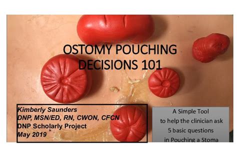 Ostomy Decisions 101 Book 806921