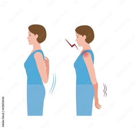 凍結肩、四十肩、五十肩、関節周囲炎で肩が痛み手が後ろに回らない女性 Stock Vector Adobe Stock