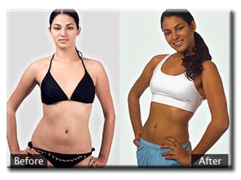 Melanotan Side Effects HubPages