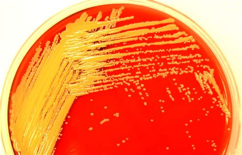 Medical Laboratory And Biomedical Science Golden Bacterium
