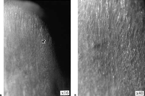 Structure Of Hyponychium Semantic Scholar