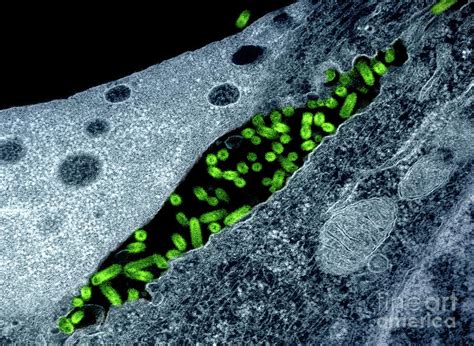 Vesicular Stomatitis Virus Infection 1 By Niaidscience Photo Library