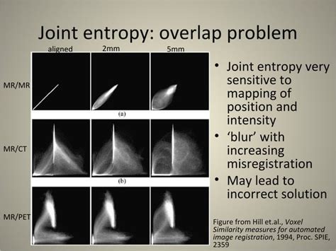 Mutual Information Algorithm Applied To Rigid Registration Ppt Free Download
