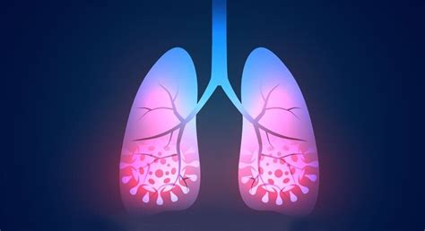 Какие бывают болезни легких Медицинское образование АМО Дзен