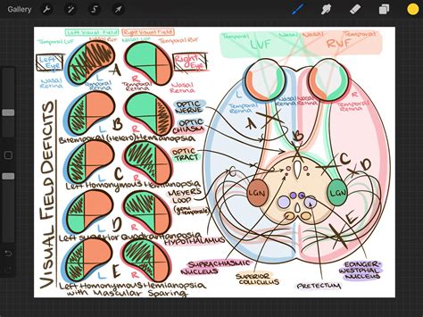 Visual Fields Anyone Rpenmanshipporn