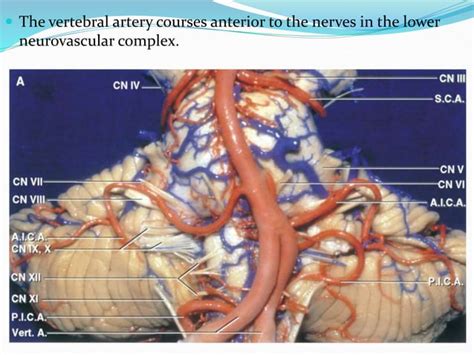 Lower Cranial Nerves Ajay Ppt