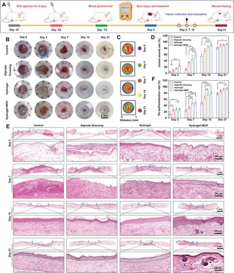 Thermosensitive Hydrogel Integrated With Bimetallic Nano‐enzymes For Modulating The