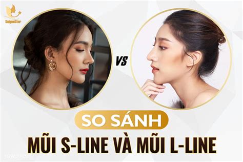 Nâng Mũi S Line Và L Line Khác Nhau Như Thế Nào