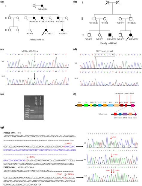Identification Of Two Novel Prpf31 Mutations In Chinese Families With