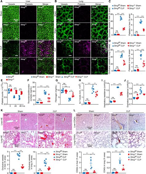 Sting Activation In Platelets Aggravates Septic Thrombosis By Enhancing Platelet Activation And