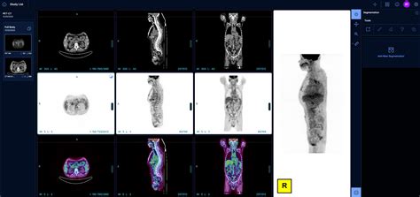 Tmtv Mode Flywheel Documentation