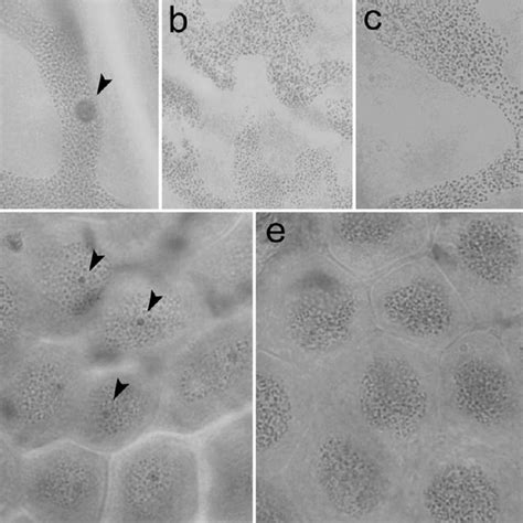 Sex Chromatin In Interphase Nuclei Of Adult Ostrinia Furnacalis Download Scientific Diagram