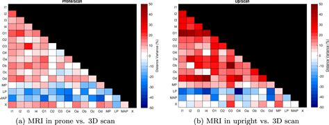 3d Digital Breast Cancer Models With Multimodal Fusion Algorithms The Breast