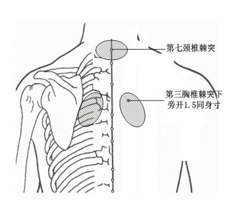 龙中医一院儿科二科丨儿童三伏贴即将开始啦 皮肤 疾病 局部