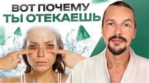 Как избавиться от ОТЕКОВ? 5 причин возникновения. УСТРАНИ ИХ! - YouTube