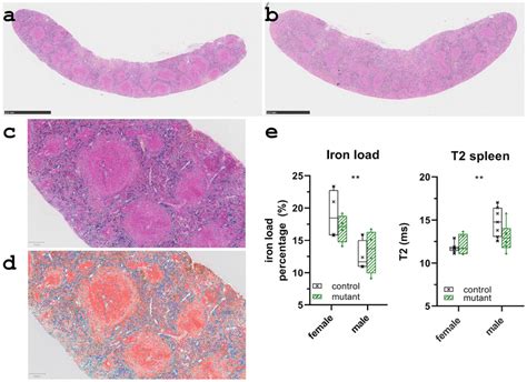 Quantification Of The Splenic Iron Load A Example Of A Control