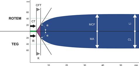 The Difference In The Terminology Of The Most Important Results Between Download Scientific