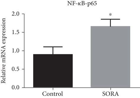 Gene Expression Analysis Rna Was Isolated From The Liver Of Different