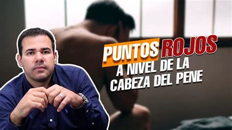 Manchas Rojas En El Glande Sin Picor Ni Dolor Cavitaciones