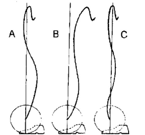 Three Types Of Barbell Trajectory In Snatch Weightlifting Vertical Download Scientific Diagram