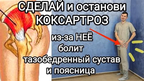 Останови КОКСАРТРОЗ из за этой мышцы болит тазобедренный сустав и поясница перекос таз… в