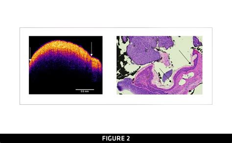 Vibrational Virtual Biopsy Optovibronex