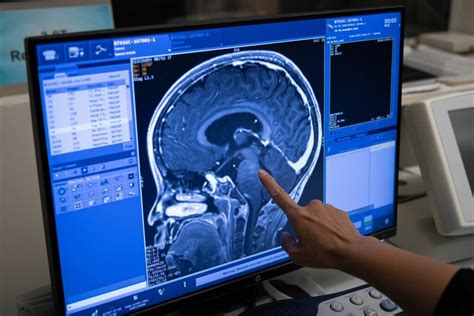 Consensus Paper Reviews Use Of Focused Ultrasound To Help Treat Diffuse