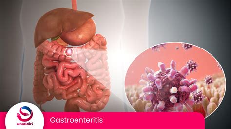 Gastroenteritis Sehatidiri