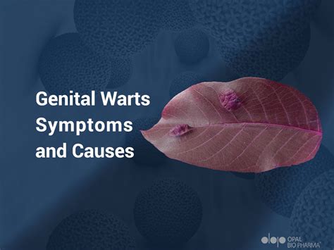Genital Warts Symptoms Causes Pathophysiology Diagnosis Treatment