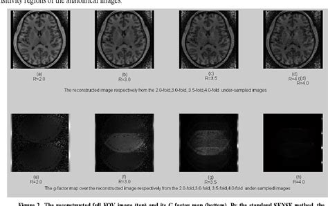 Figure 2 From A Method For Estimating The Coil Sensitivity Maps From