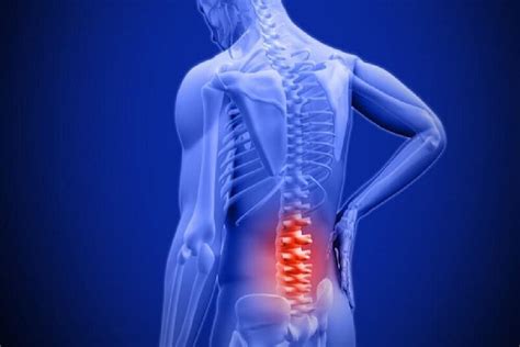 تولید سیستم سنجش اختلالات و ناهنجاری‌های اسکلتی در کشور ایسنا