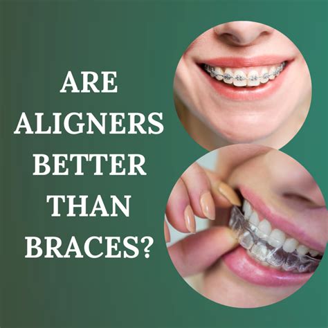 Aligners Vs Braces What To Choose Risus Dental Nagaram
