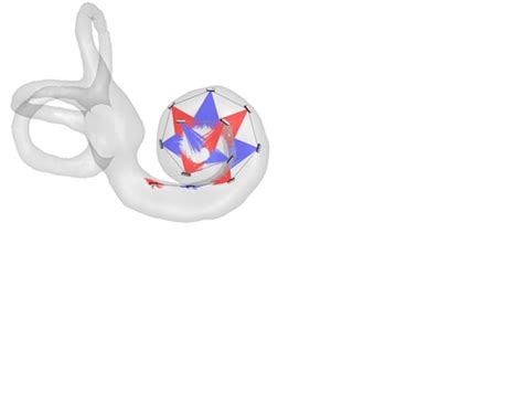 Cochlear Implant Programming Illustration Caos Computer Assisted