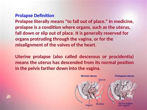 Uterine Prolapse In Displacement Finalppt Pregnancy Reproductive