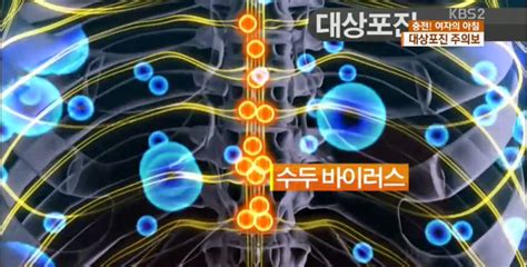 대상포진 예방법 극심한 통증 유발한 가려움증 이것으로 해결한다 사회 기사 더팩트
