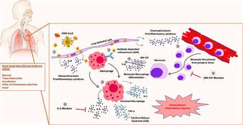 Figure 1 From Role Of Monocytesmacrophages In Covid 19 Pathogenesis