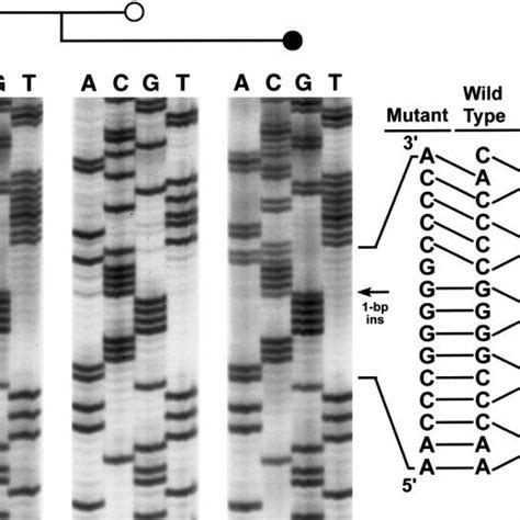 A Direct Sequence Of Exon 1 In The Region Surrounding Codon 9