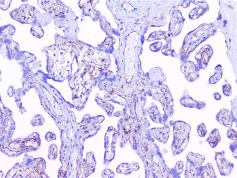 Collagen Iii Antibody Pa5 95595