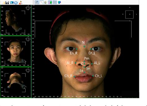 Nasal Protrusion Line Semantic Scholar