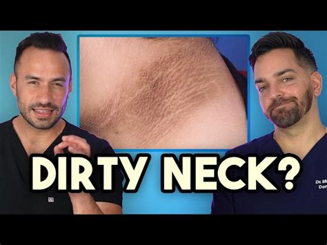 What Is Black Spots On Neck