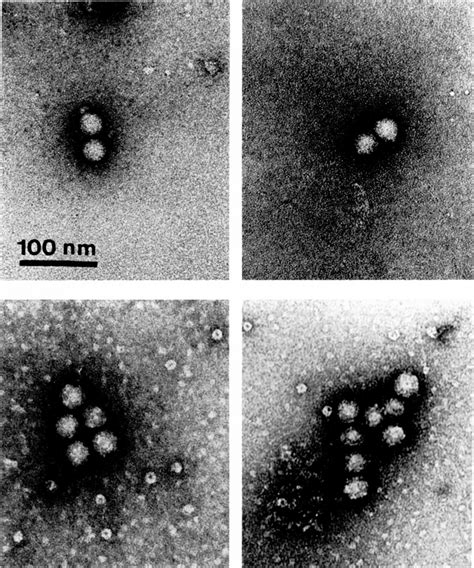 Electron Micrographs Of Hav Particles From Csci Gradient Fraction No
