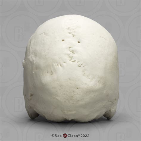 Human Elderly European Male Skull Bone Clones Osteological