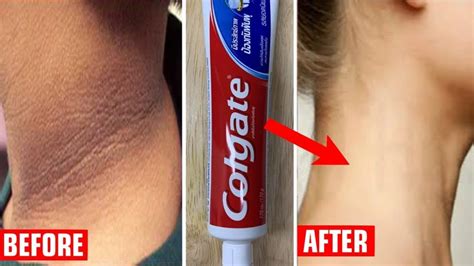 Mix Vaseline And Colgate Toothpaste And Watch What Happens