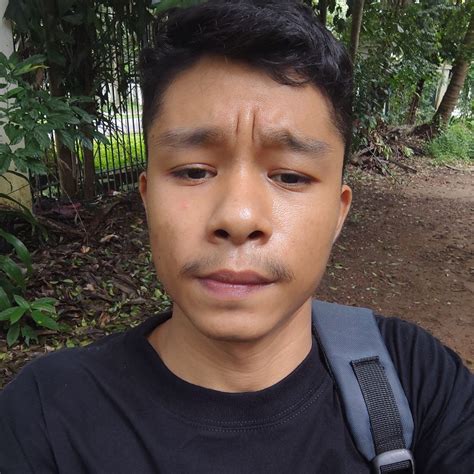 Highlights Myanmar ဂျူဗင်တပ်ကွင်းလယ်လူပေါ့ဘာဟာ ကာလရှည်ဒဏ်ရာပြသနာကနေ