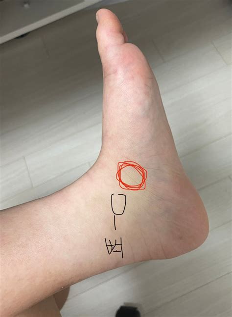 발 안쪽 통증 지식in