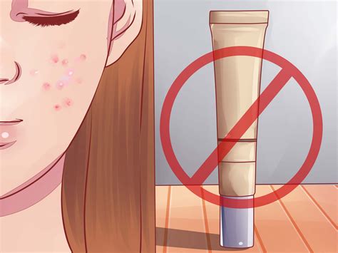 How To Avoid Skin Pigmentation During Pregnancy With Pictures
