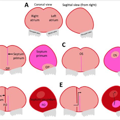 A Schematic Representations Of The Common Atrium Prior To Septation
