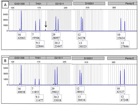 Dna Profiling